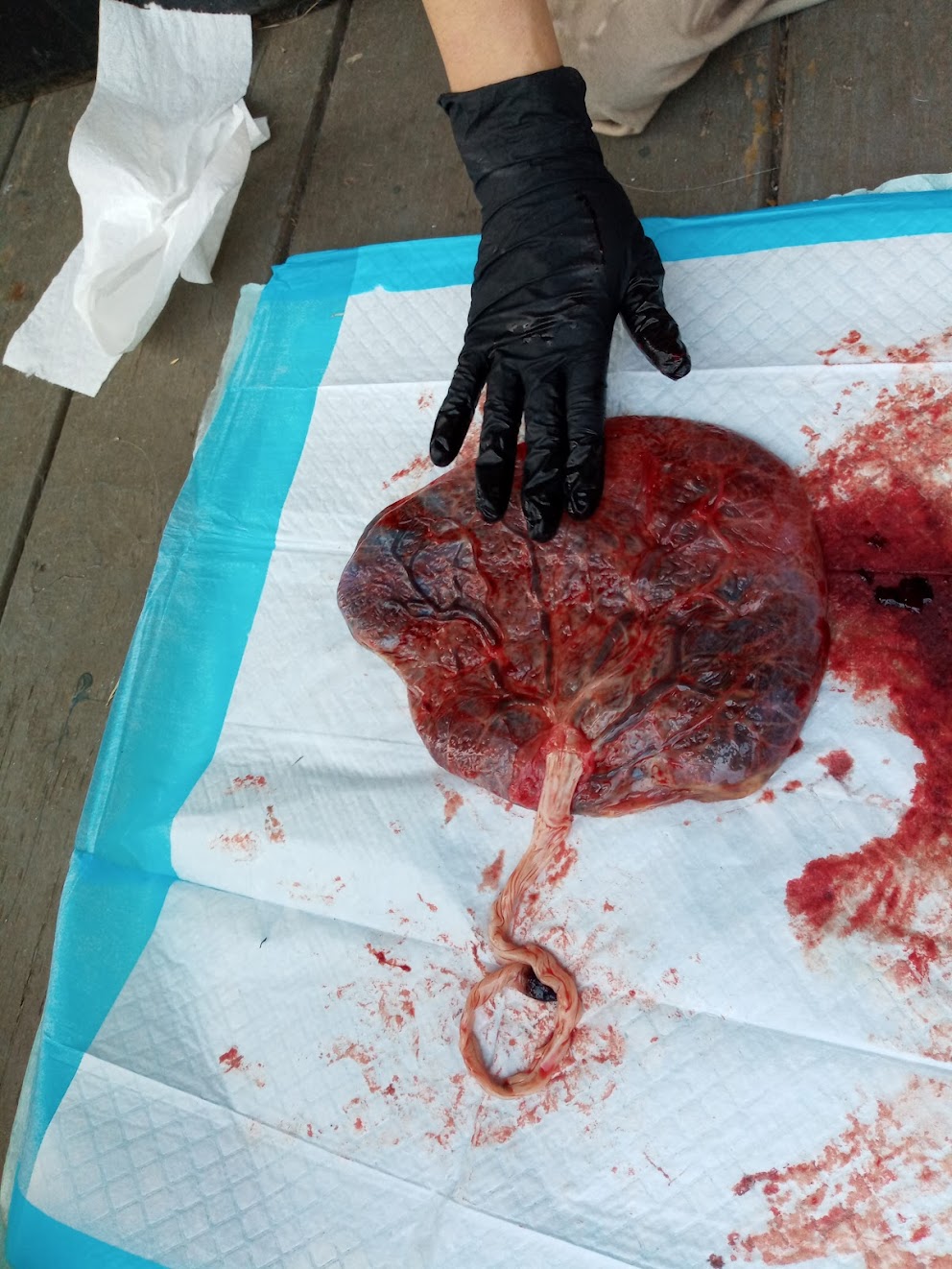 Planting the Placenta: How I Honored my Placenta and how it Resembles ...